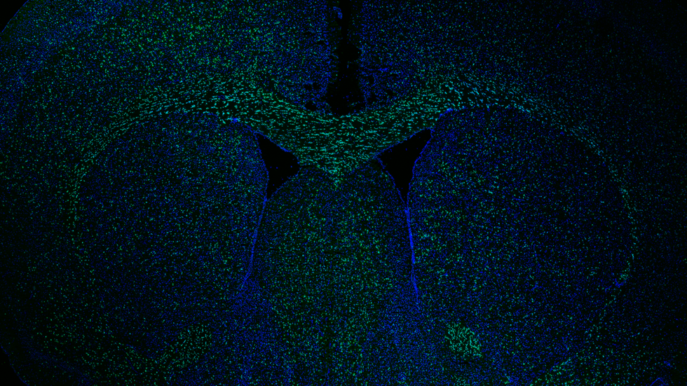 A map of the aging brain | Harvard Stem Cell Institute (HSCI)