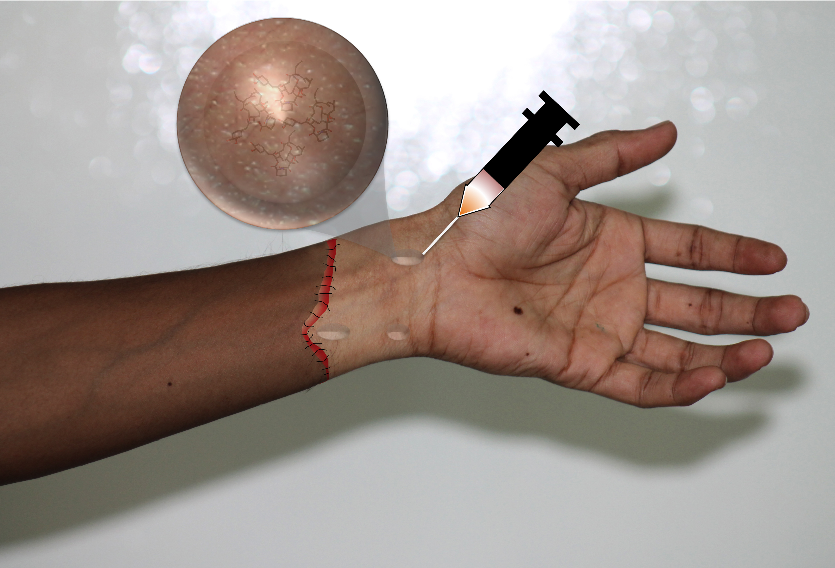 Bioengineering a better quality of life for recipients of hand ...